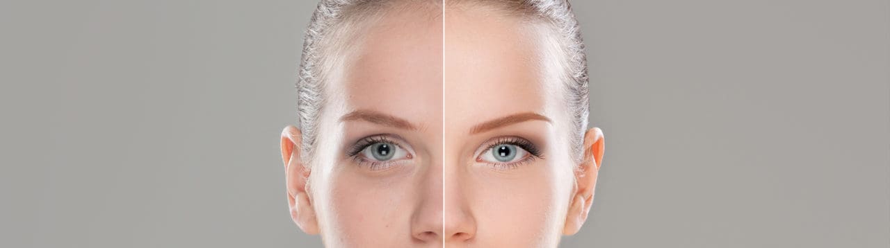 Oculofacial Plastic Surgery Before and After Pictures | Eyelid Surgeons ...